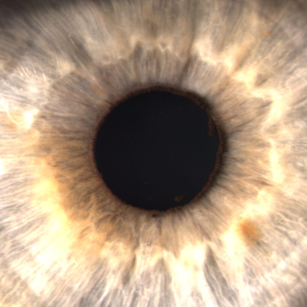 Keeler blog: Love Your Eyes: The importance of eye examinations & early ...