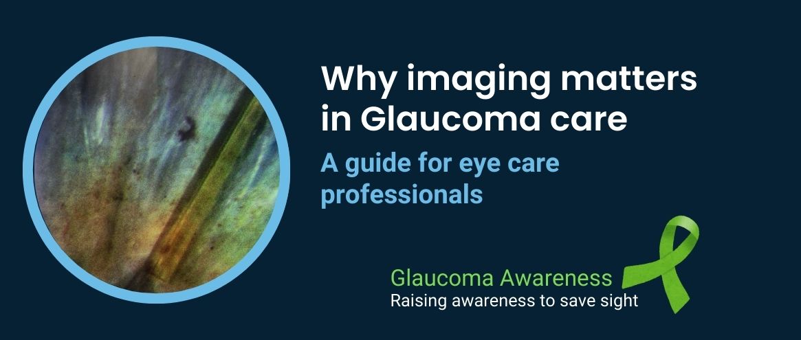 Why imaging matters in Glaucoma care - Keeler Global